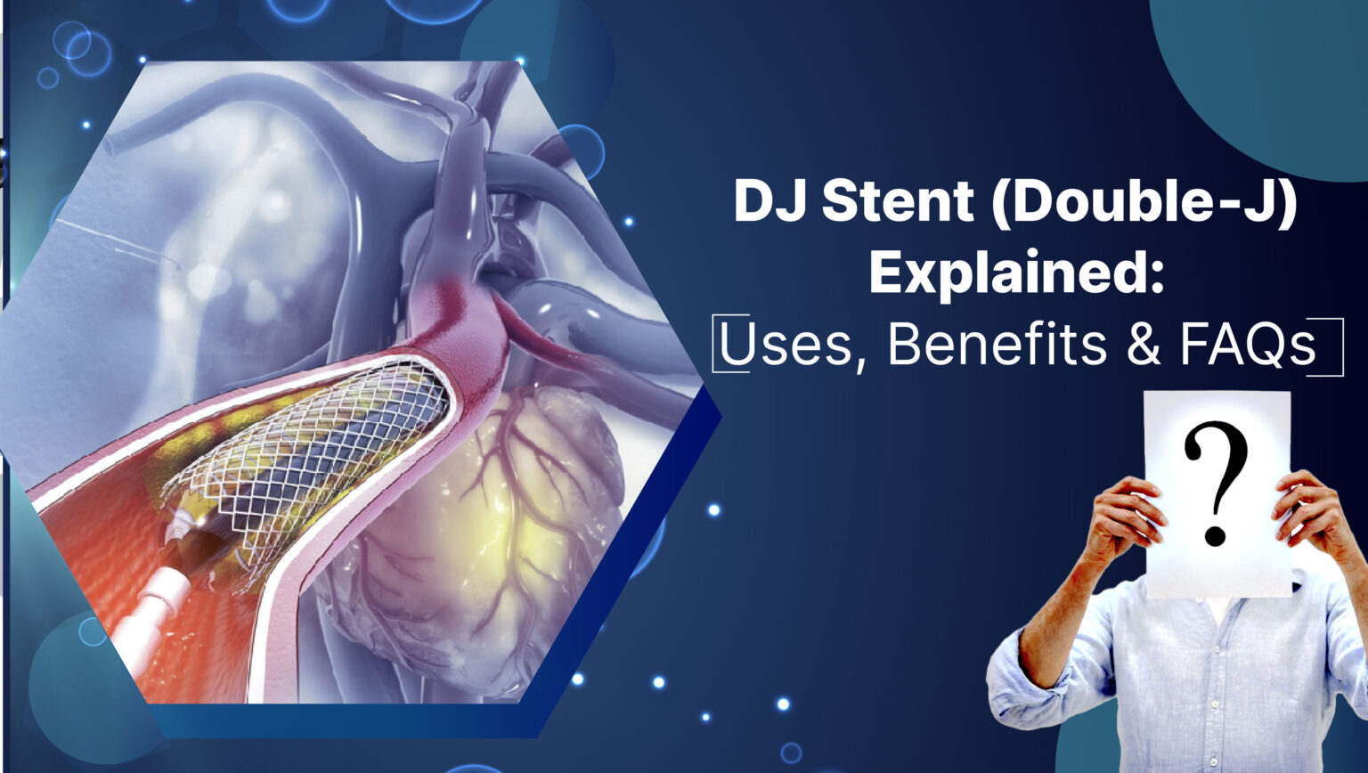 DJ Stent (Double‑J) Explained: Uses, Benefits & FAQs - The CureStone